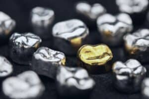 Zahnersatz aus Gold beim Zahnarzt: Wann ist eine Goldkrone die richtige ...